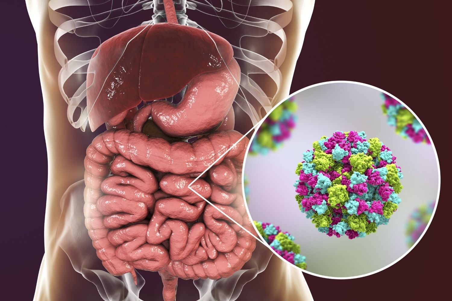 What You Need To Know About Norovirus Infection